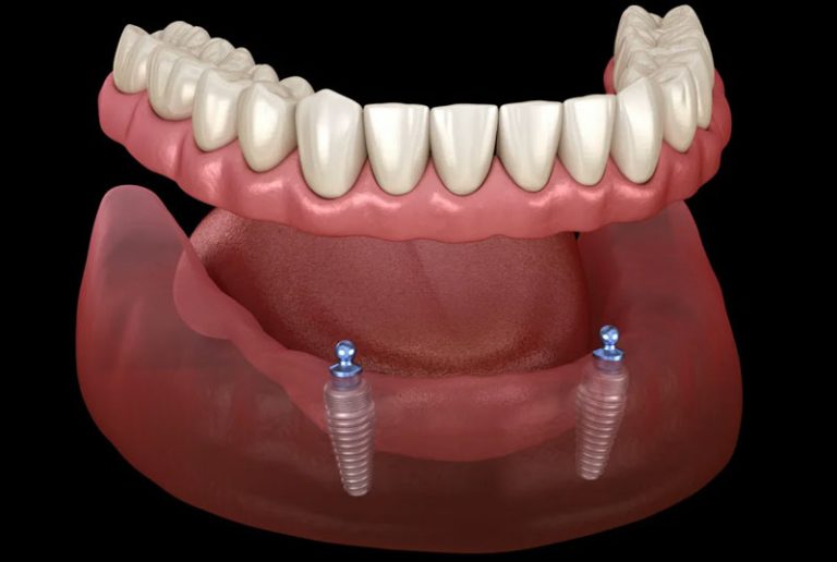 OMSI – Oral & Maxillofacial Surgery Institute